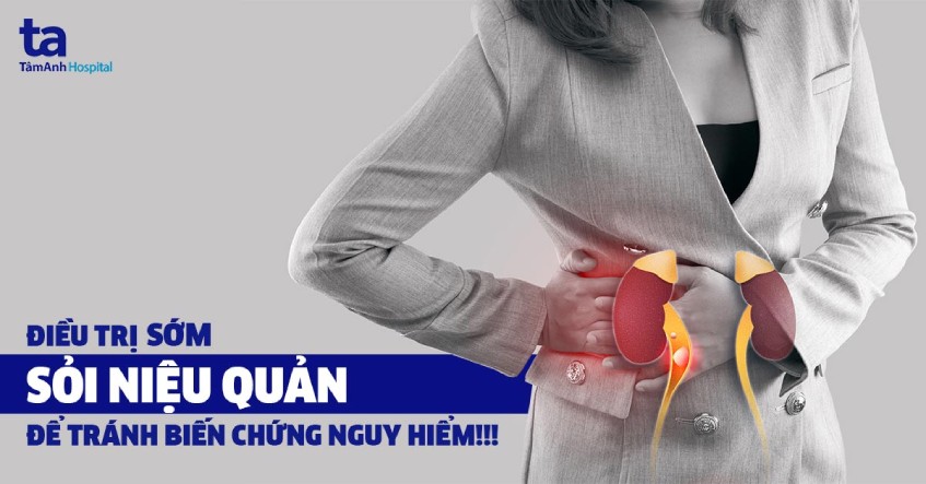 4 cách điều trị sỏi niệu quản an toàn hiệu quả, khoa học