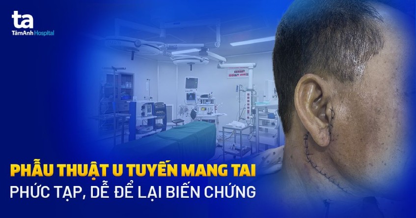 Phẫu thuật khối u tuyến mang tai phức tạp ở bệnh nhân lớn tuổi