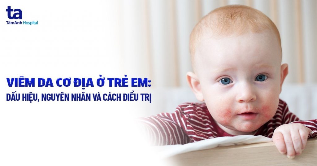 Viêm da cơ địa ở trẻ em: Dấu hiệu, nguyên nhân và cách điều trị