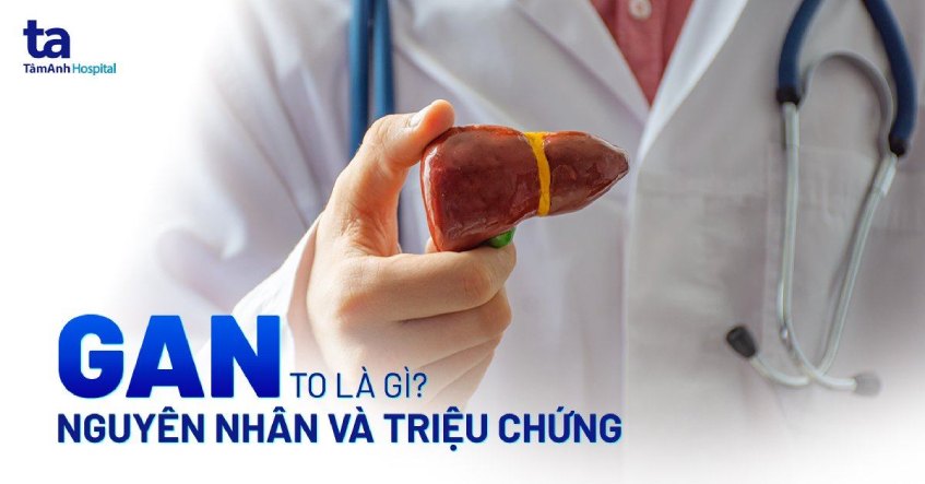 Gan to là gì? Nguyên nhân, triệu chứng, chẩn đoán và phòng ngừa