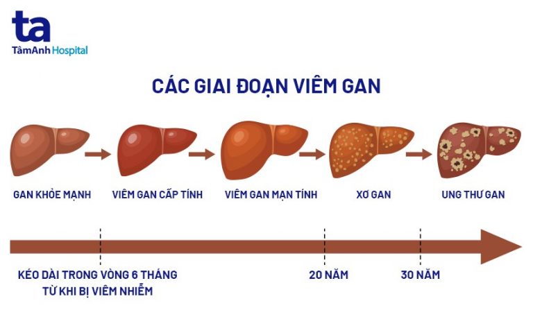 Viêm gan mạn tính: Nguyên nhân, triệu chứng, chẩn đoán và phòng ngừa