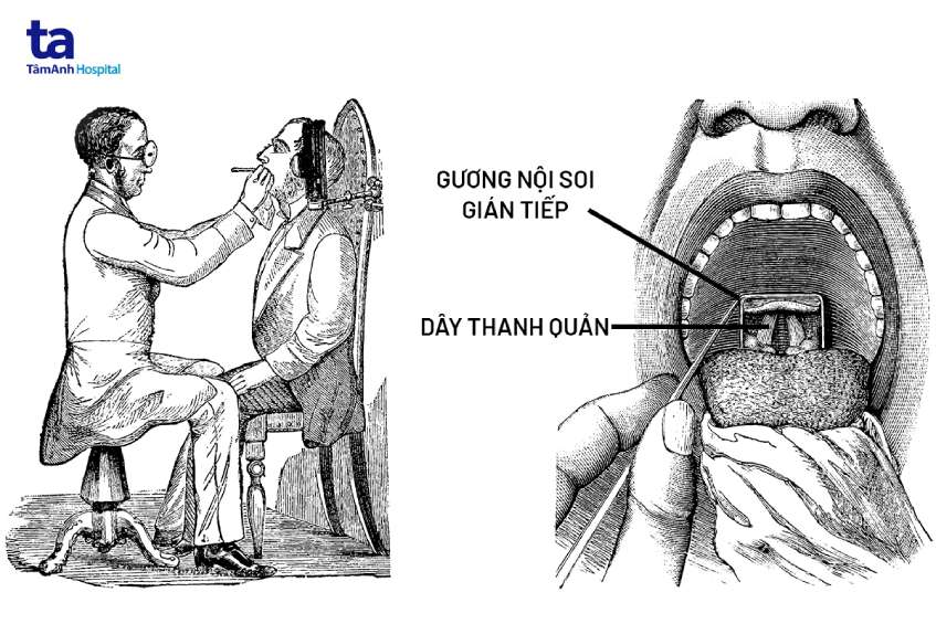 Nội soi thanh quản: Khi nào cần thực hiện? Quy trình và lưu ý