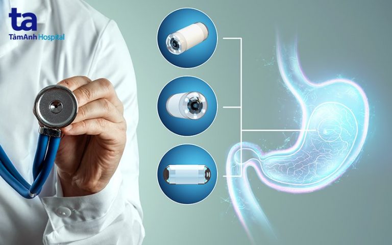 Đau Dạ Dày đau Bao Tử Nguyên Nhân Triệu Chứng Và Chẩn đoán