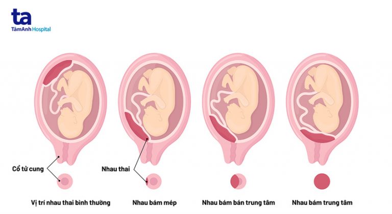 Rau bám mép có nguy hiểm không? Nguyên nhân, dấu hiệu, phòng ngừa ...