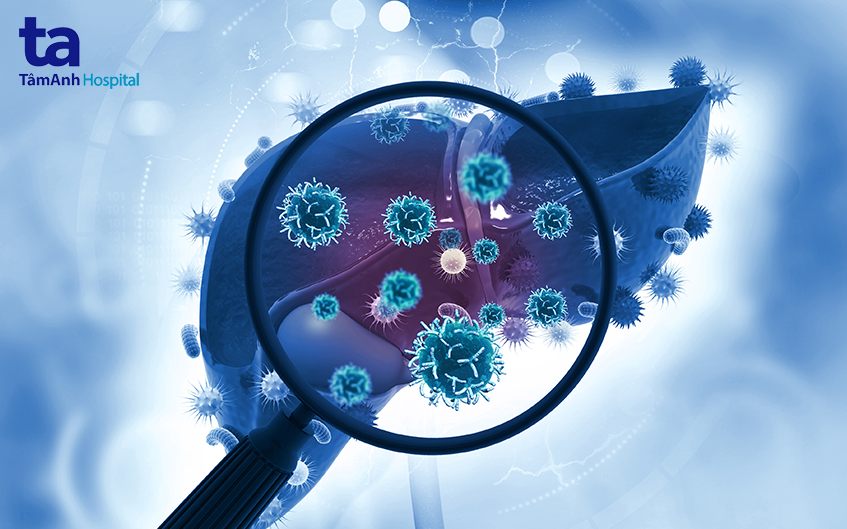 Xơ gan mất bù: Nguyên nhân, triệu chứng và cách phòng ngừa