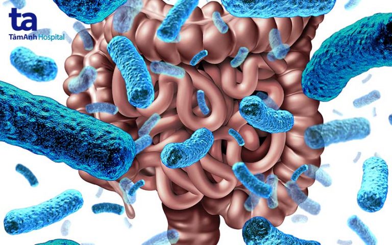 Nhiễm vi khuẩn Salmonella: Nguyên nhân, biểu hiện, chẩn đoán, phòng ngừa