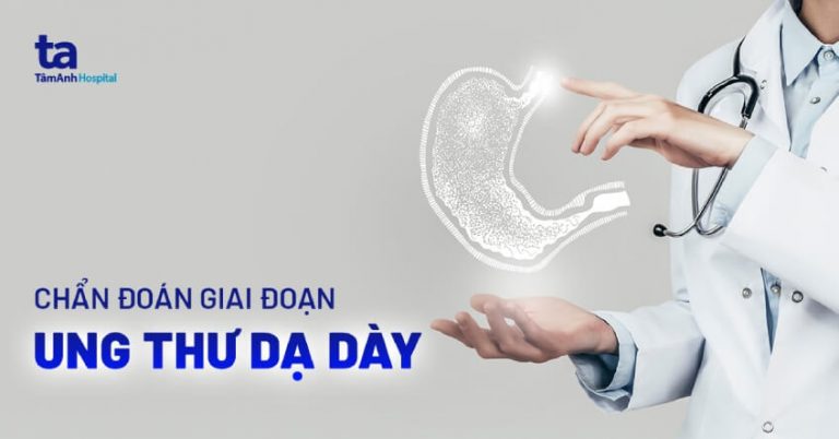5 giai đoạn ung thư dạ dày: Cách đánh giá và chẩn đoán chi tiết