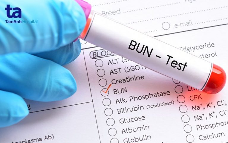 Xét nghiệm ure máu để làm gì? Những thông tin cần biết