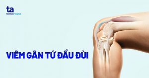 Viêm gân tứ đầu đùi: Nguyên nhân, triệu chứng, chẩn đoán, điều trị