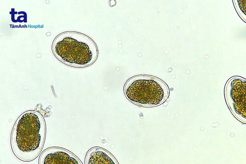 Giun móc là gì? Đặc điểm hình thể, ấu trùng phát triển thế nào?