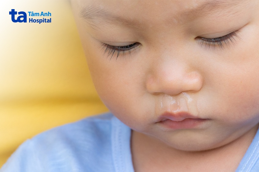 Lang ben ở trẻ sơ sinh: Nguyên nhân, dấu hiệu và cách phòng ngừa
