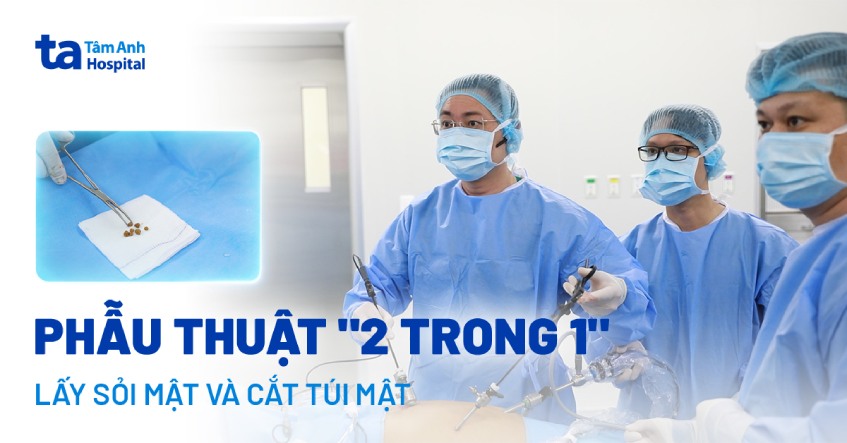Phẫu thuật “2 trong 1” lấy sỏi ống mật chủ và cắt túi mật