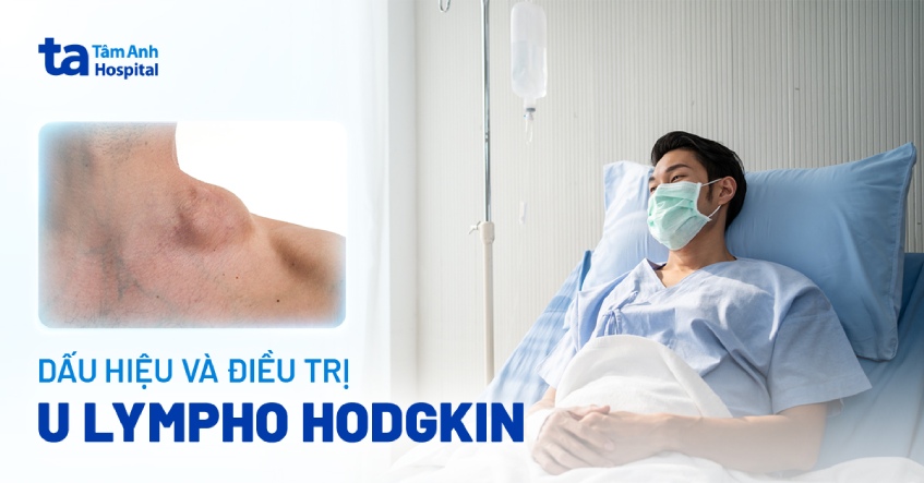U lympho hodgkin: Dấu hiệu, nguyên nhân và cách điều trị