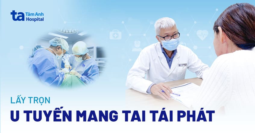 Giữ trọn vẹn mặt cho bệnh nhân có u tuyến mang tai tái phát