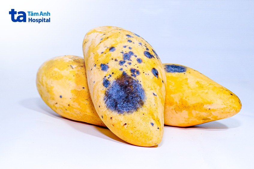 Giang mai giai đoạn 3 có chữa được không? Dấu hiệu và chẩn đoán