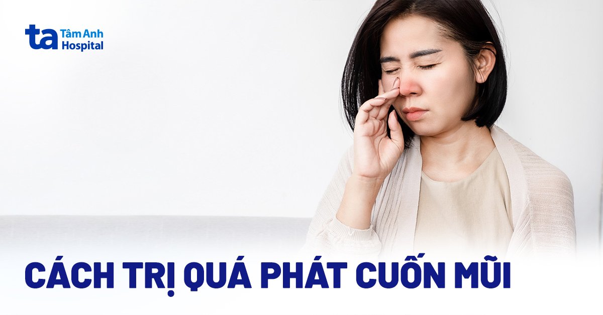 Quá phát cuốn mũi: Nguyên nhân, triệu chứng và cách điều trị