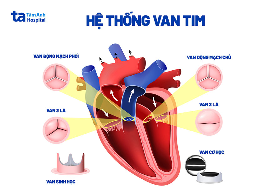 Phẫu thuật thay van tim: Quy trình và các biến chứng rủi ro