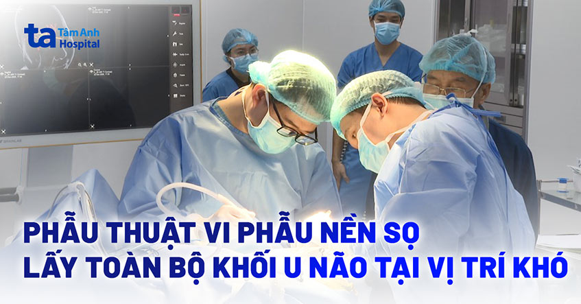 Phẫu thuật vi phẫu nền sọ lấy toàn bộ khối u não tại vị trí khó