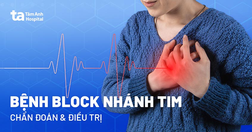 Block nhánh phải không hoàn toàn là gì? Nguyên nhân và chẩn đoán sớm