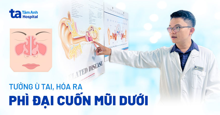 Tưởng ù tai hóa ra phì đại cuốn mũi dưới | BVĐK Tâm Anh