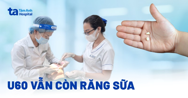 U60 vẫn còn răng sữa | Bệnh viện Đa khoa Tâm Anh