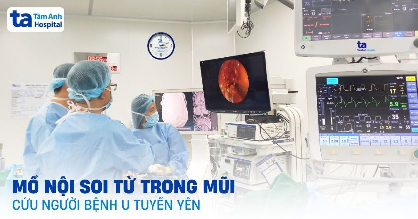Mổ nội soi từ trong mũi cứu người bệnh u tuyến yên