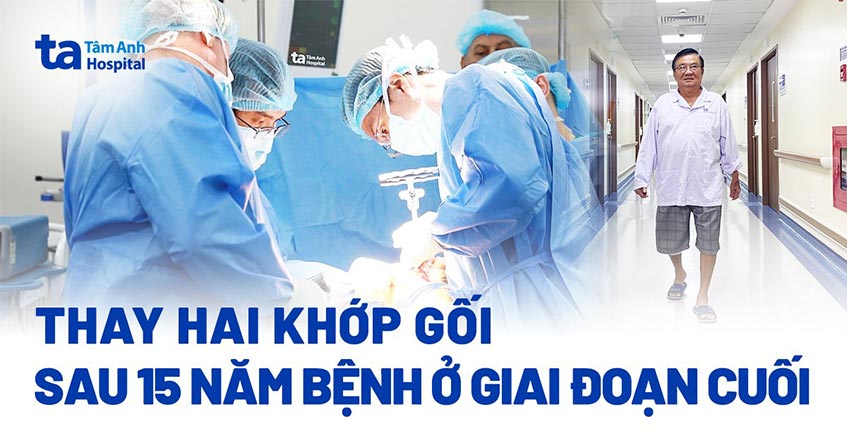 Thay hai khớp gối sau 15 năm bệnh ở giai đoạn cuối