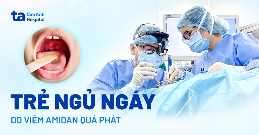 Trẻ ngủ ngáy do viêm amidan quá phát | BVĐK Tâm Anh