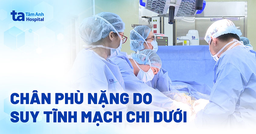 Phù chân tưởng suy thận hóa suy tĩnh mạch chi dưới