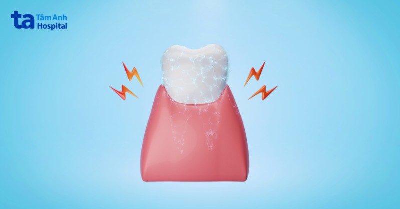 Nang thân răng là gì? Có nguy hiểm không? Cách điều trị