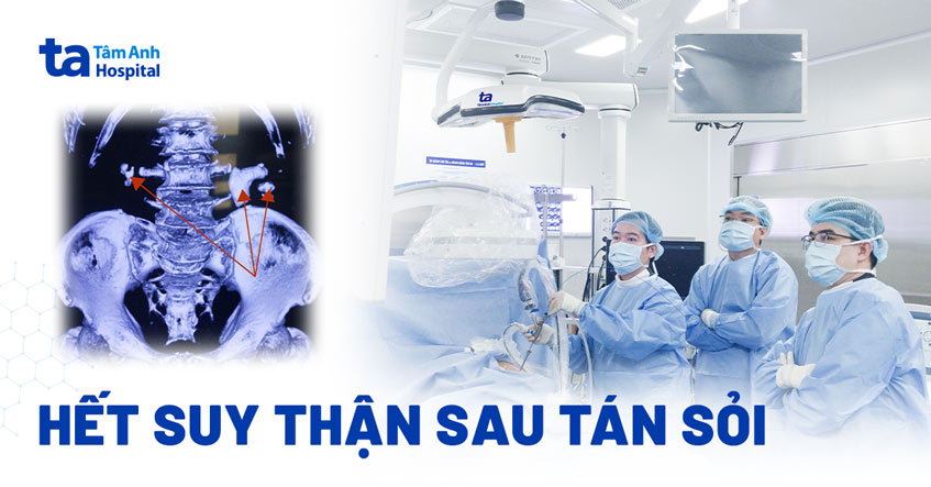 Chuyên mục tin tức | Bệnh viện Đa khoa Tâm Anh