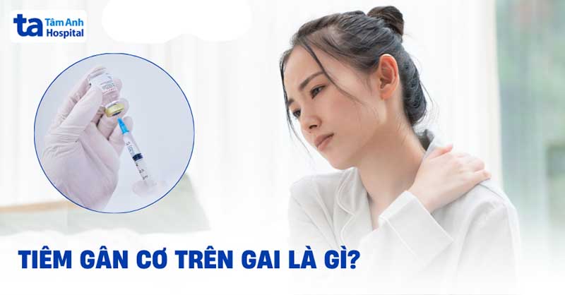 Tiêm gân cơ trên gai là gì? Ưu điểm và quy trình thực hiện