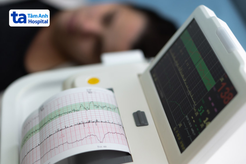 Block nhánh phải không hoàn toàn là gì? Nguyên nhân và chẩn đoán sớm