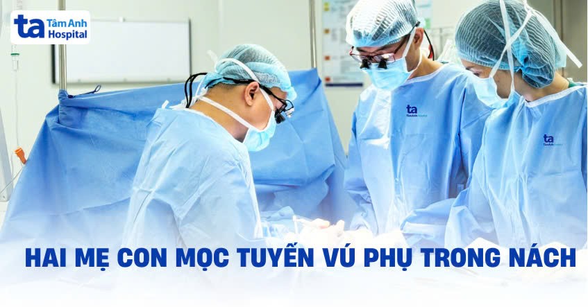 Hai mẹ con mọc tuyến vú phụ trong nách do yếu tố gia đình