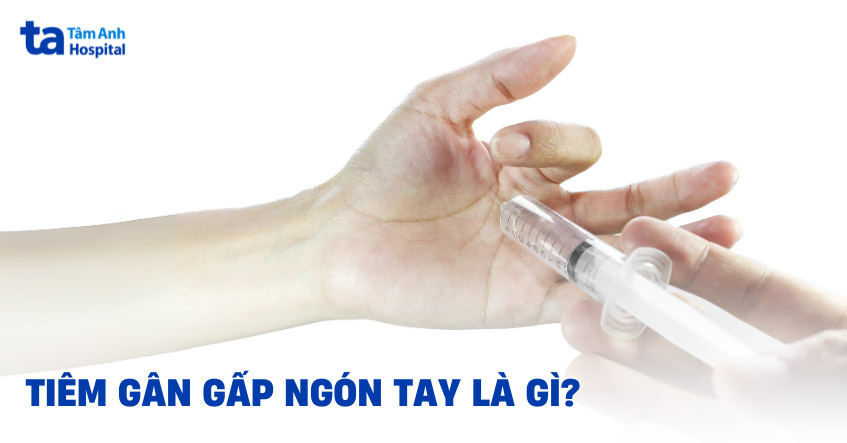 Kỹ thuật tiêm gân gấp ngón tay là gì? Có ưu điểm gì?