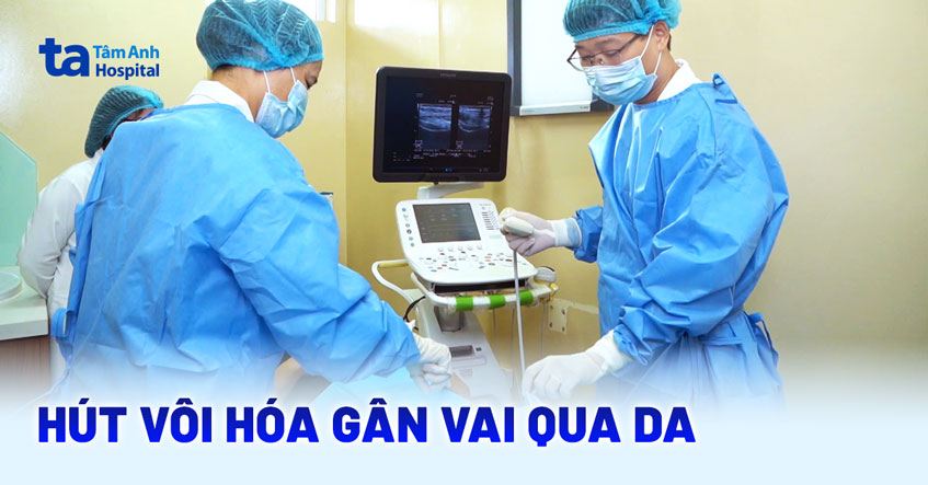 Gân vai vôi hóa do bê vác nặng | Bệnh viện Đa khoa Tâm Anh