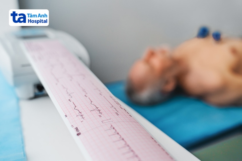 Máy đo điện tim: Cấu tạo, cách sử dụng và nguyên lý hoạt động