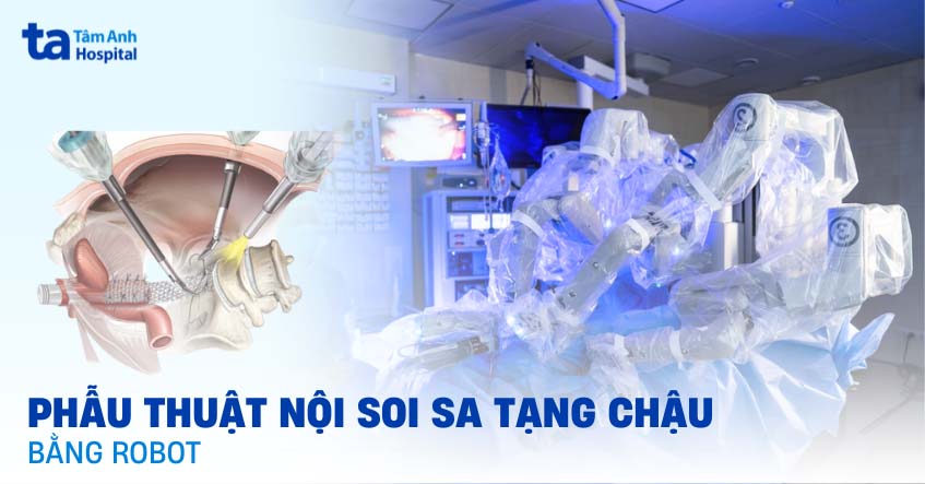 Phẫu thuật nội soi sa tạng chậu bằng robot: Ưu điểm, chỉ định