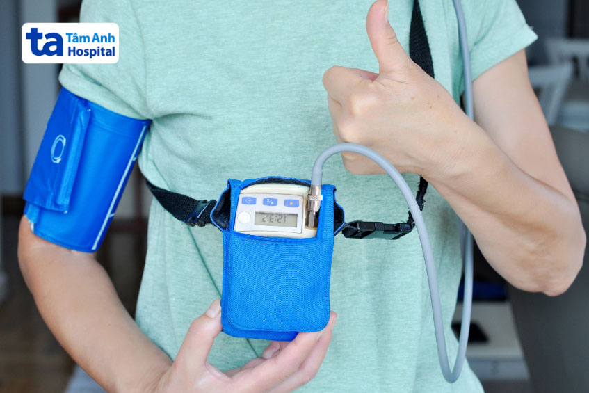 Đo Holter điện tâm đồ (ECG): Chỉ định, ưu điểm và quy trình