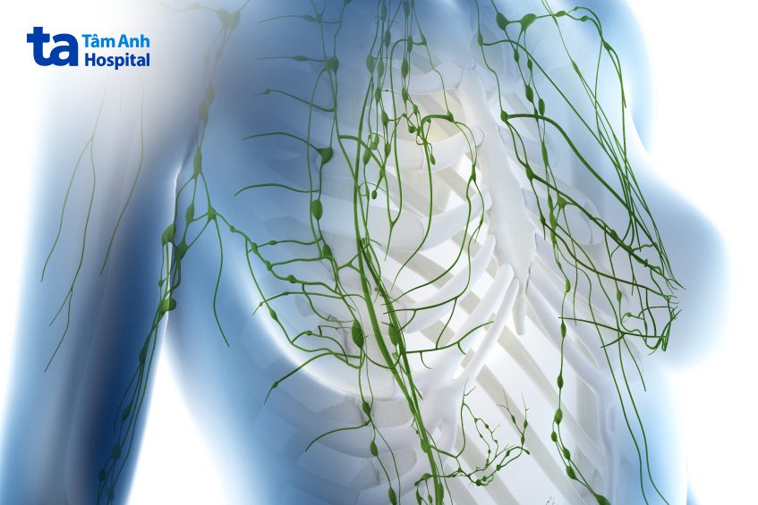 Vi di căn trong ung thư vú: Chẩn đoán, cách điều trị và tiên lượng