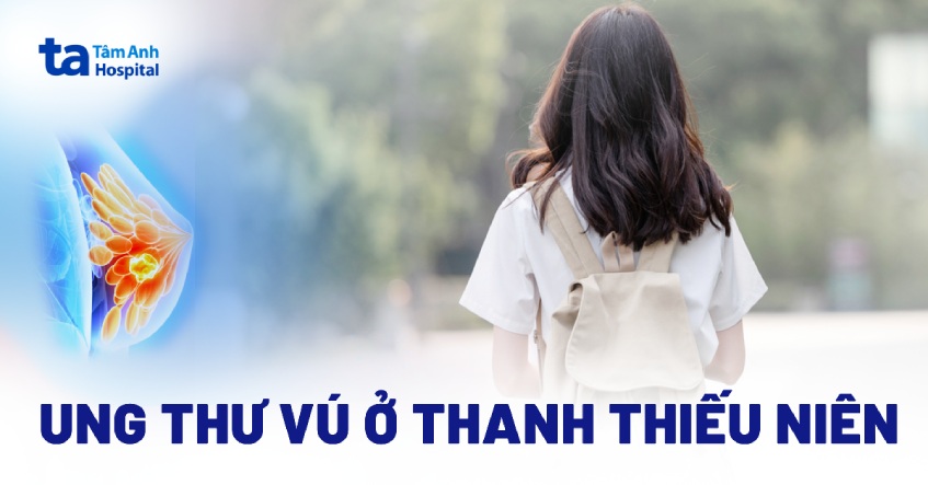 8 dấu hiệu ung thư vú giai đoạn đầu cần nhận biết sớm ở phụ nữ