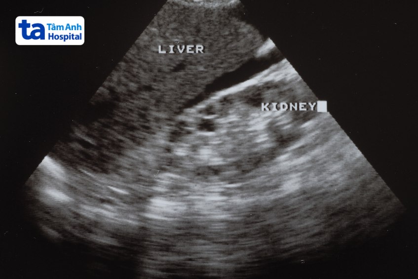 Siêu âm FAST: Quy trình thực hiện, ưu điểm và hạn chế