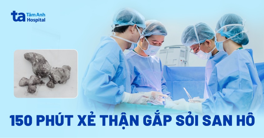 150 phút xẻ thận gắp sỏi san hô