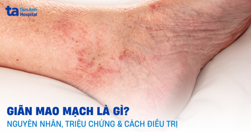 Nổi mụn ẩn trên trán: Nguyên nhân, dấu hiệu, chẩn đoán, phòng ngừa