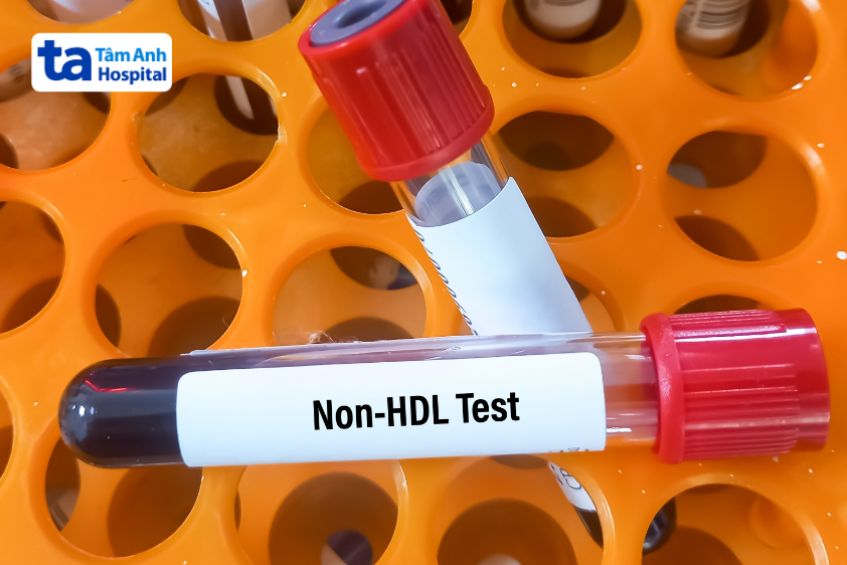 Non HDL cholesterol là gì? Cách giảm chỉ số để bảo vệ tim mạch