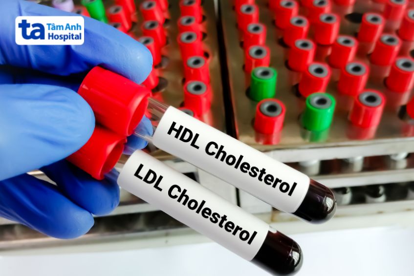 Cholesterol thấp là gì? Nguyên nhân khiến chỉ số toàn phần thấp