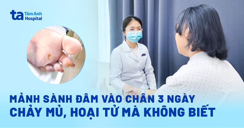 Mảnh sành đâm vào chân 3 ngày chảy mủ, hoại tử mà không biết
