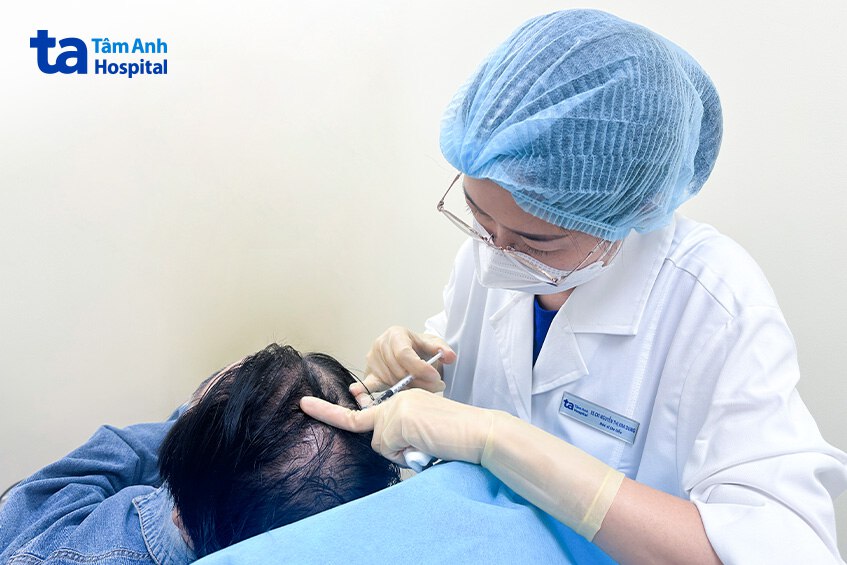 Tiêm BAP và tiêm meso khác nhau như thế nào? Cái nào tốt hơn?