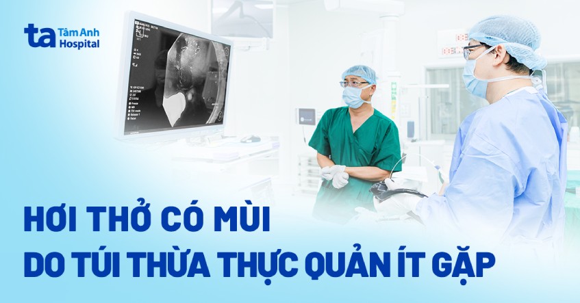 Người phụ nữ có túi thừa hiếm gặp ở thực quản