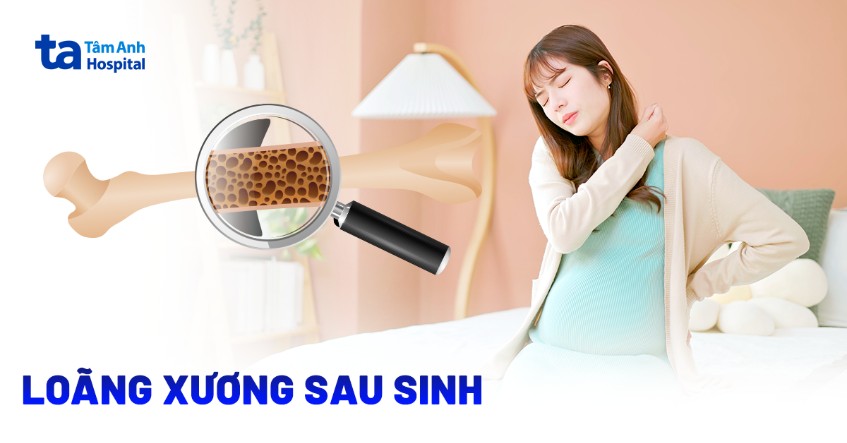 Nguyên nhân loãng xương sau sinh ở phụ nữ và cách phòng ngừa
